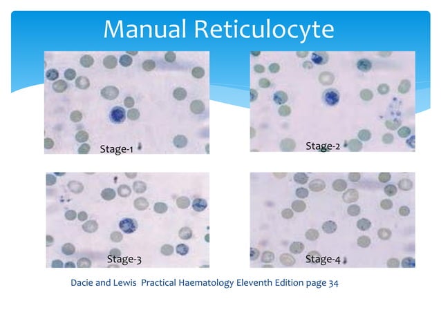 Newer reticulocyte parametes | PPT