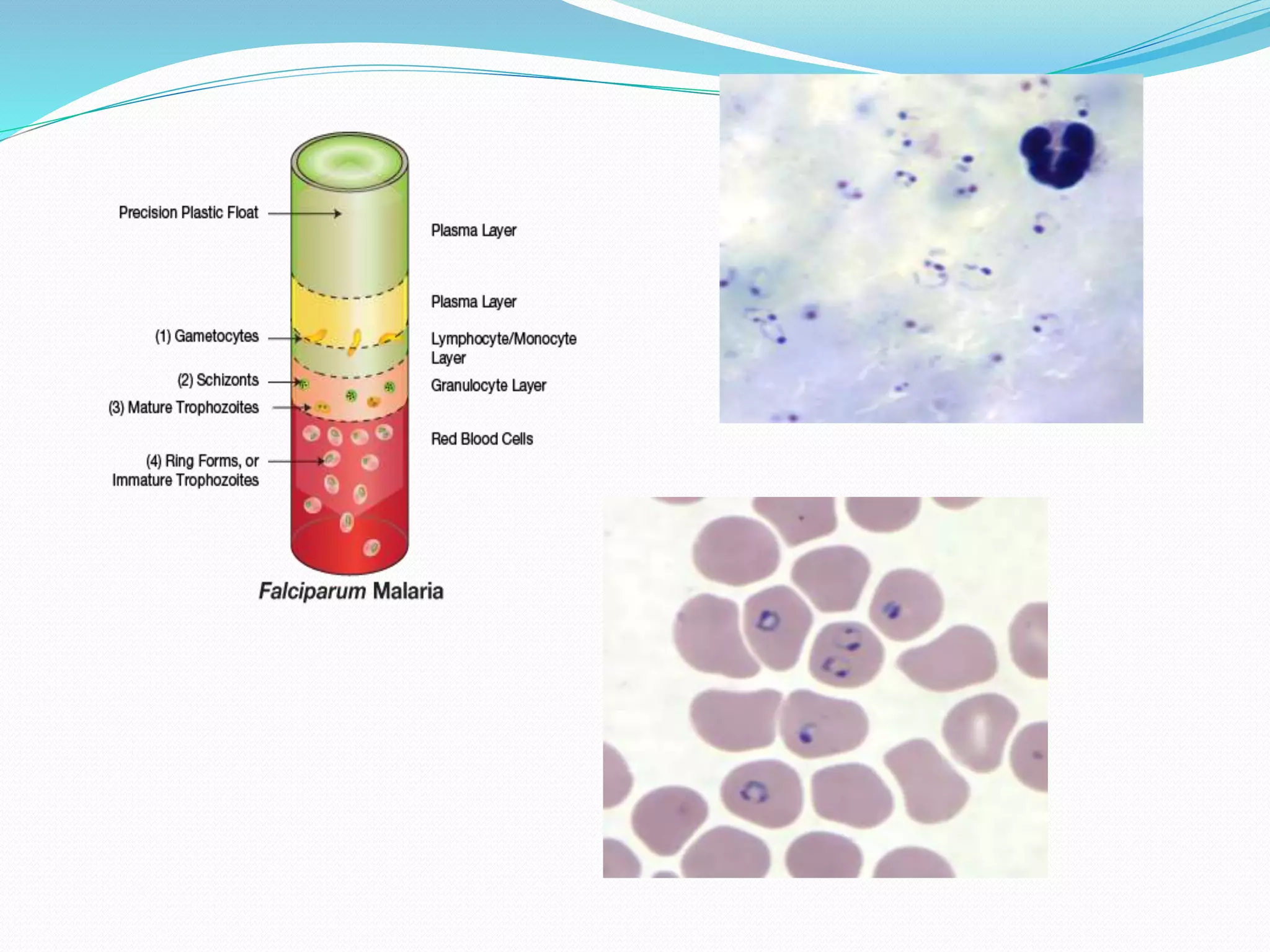 Newer techniques in laboratory diagnosis of malaria | PPTX