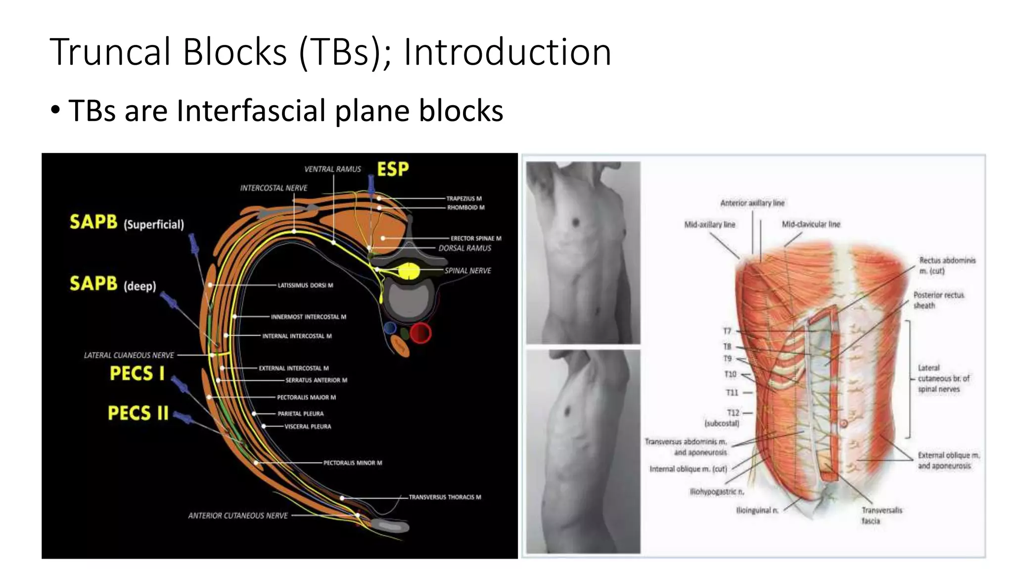 Newer Truncal Blocks Do they have place in current practice.pptx