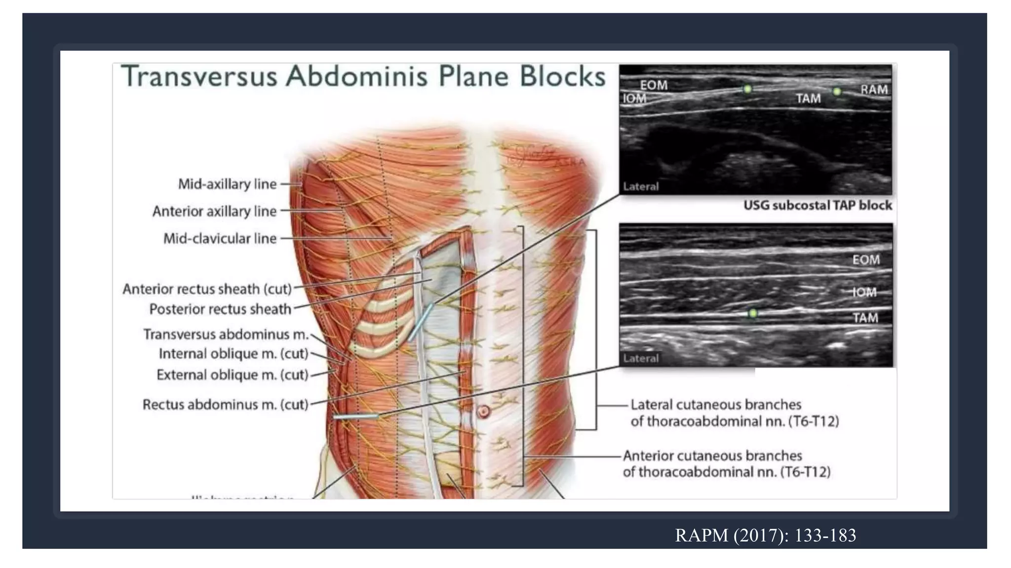 Newer Truncal Blocks Do they have place in current practice.pptx