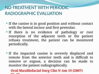 MAXILLARY CANINE impaction techniques.pptx