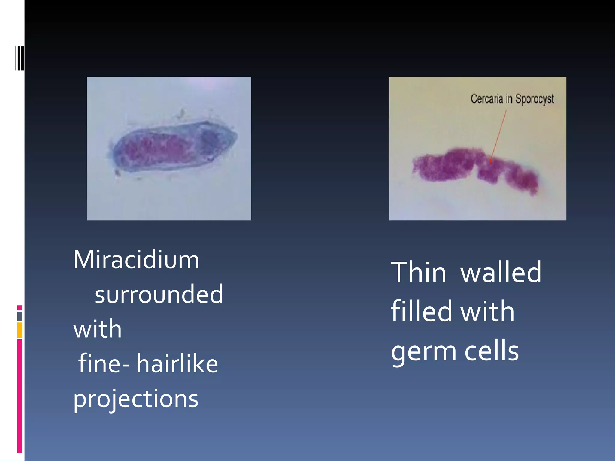 parasitology lec - FLUKES | PPT