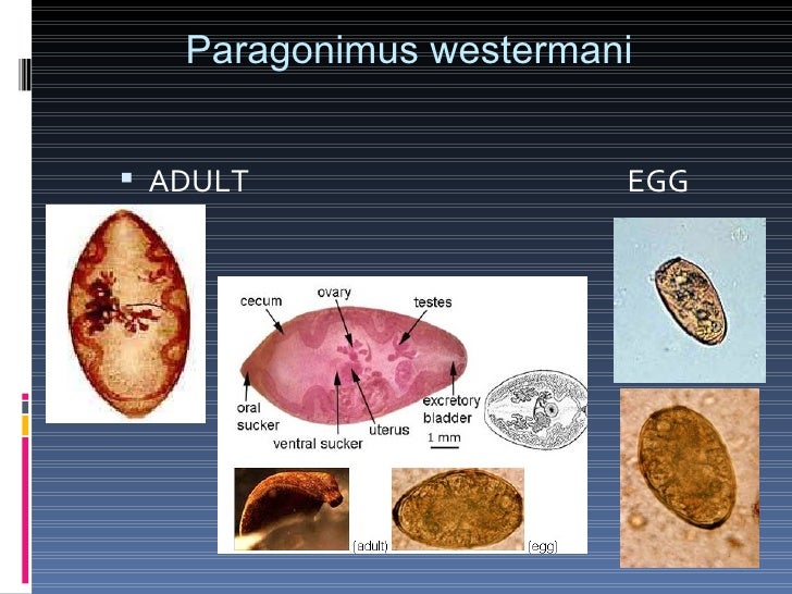 parasitology lec - FLUKES