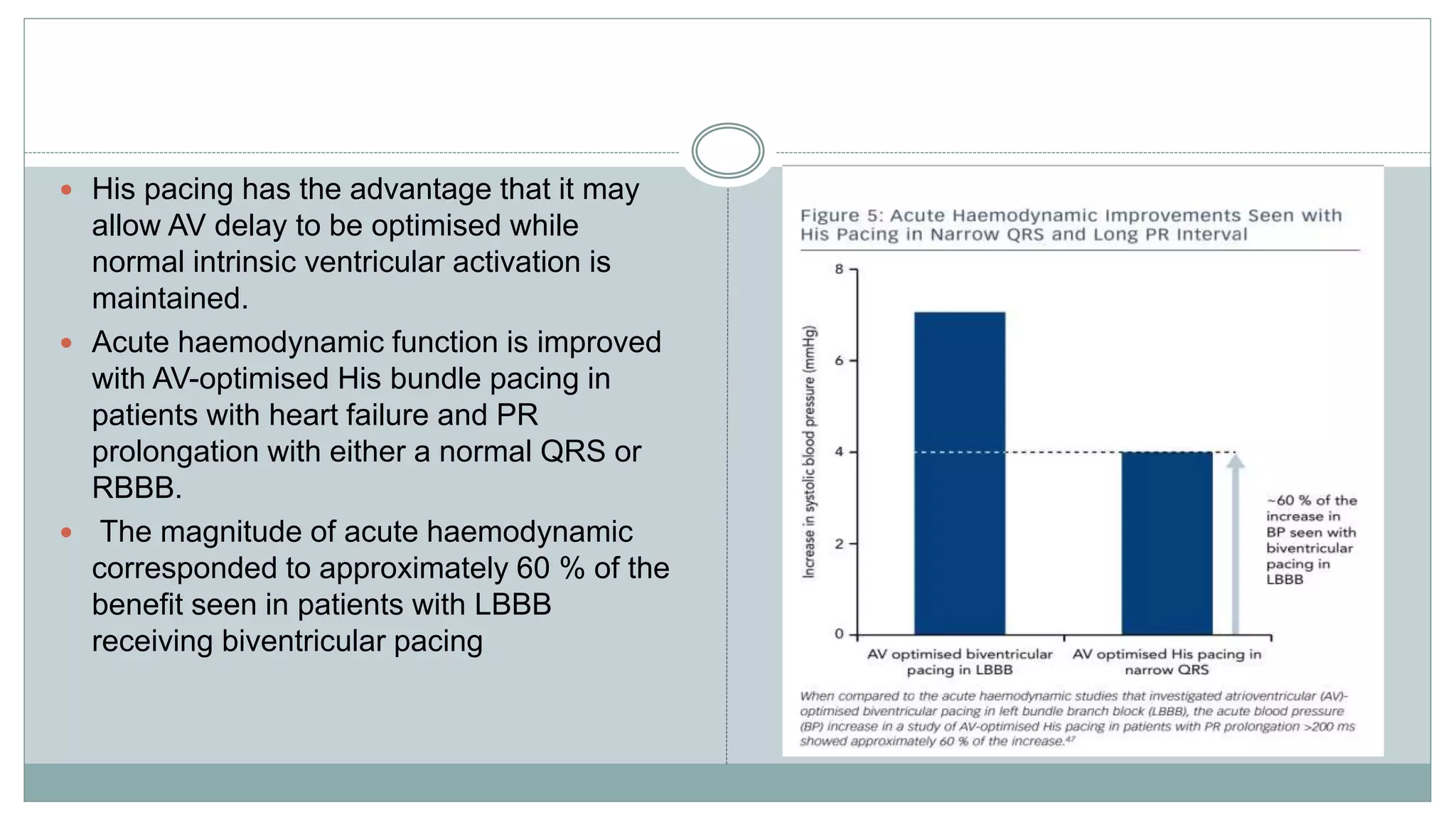 New Heart Failure modalities: HIS Bundle Pacing & Cardiac Contractility ...
