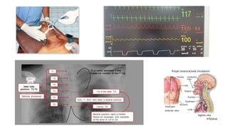 New icu patient assessment process | PPTX