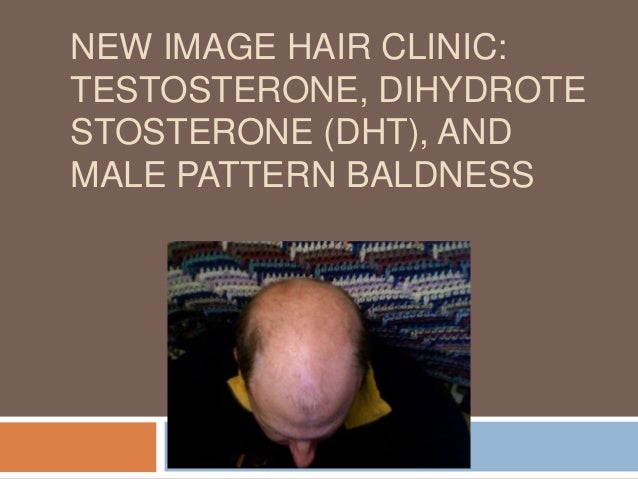 New Image Hair Clinic Testosterone Dihydrotestosterone Dht And