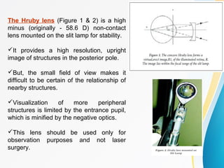 laser lenses for retinal diseases | PPT