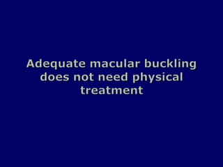 THE MANAGEMENT OF MYOPIC MACULAR HOLE RETINAL DETACHMENT | PPT