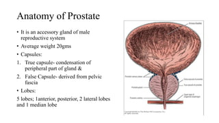 Benign Prostatic Hyperplasia | PPT