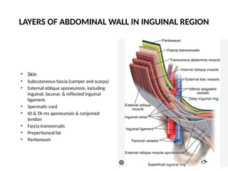 new Management of inguinal hernias AYUSH RAUNIYAR.pptx