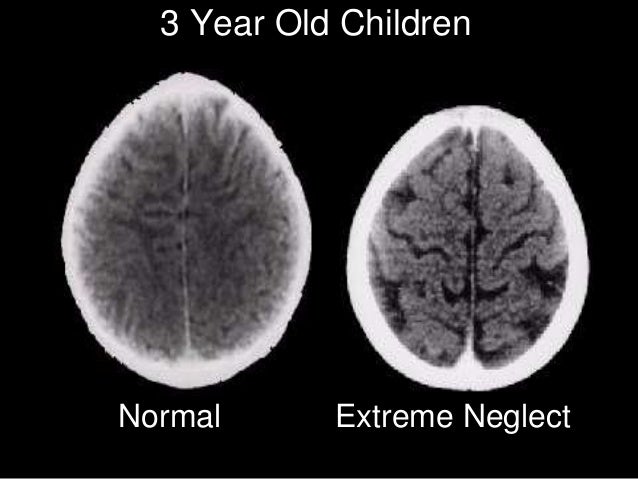 McLeod Trauma Informed Basics CEU