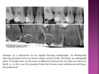 New methods to enhance diagnosis in dentistry | PPTX
