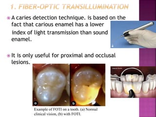 New methods to enhance diagnosis in dentistry | PPTX