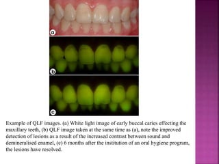 New methods to enhance diagnosis in dentistry | PPTX
