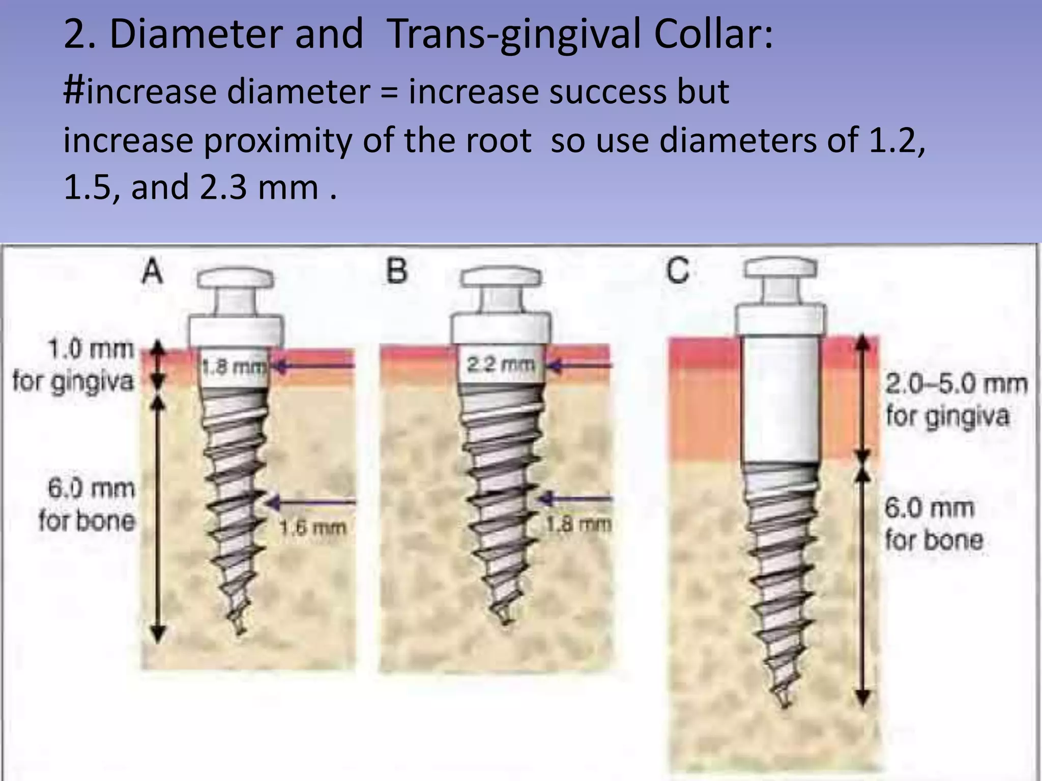 Temporary Anchorage Device (TAD) or Mini (screw ,implant) | PPTX