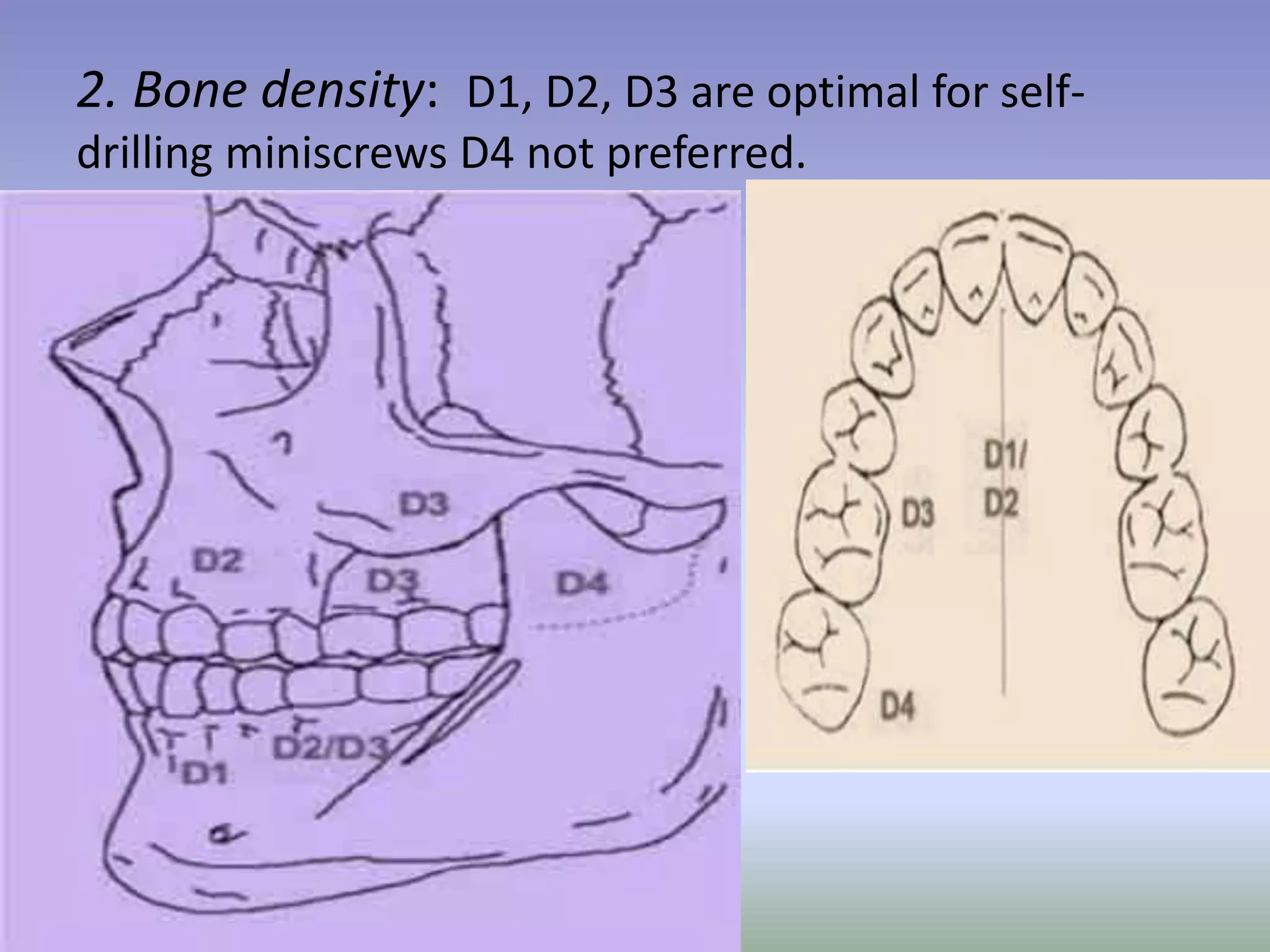 Temporary Anchorage Device (TAD) or Mini (screw ,implant) | PPTX
