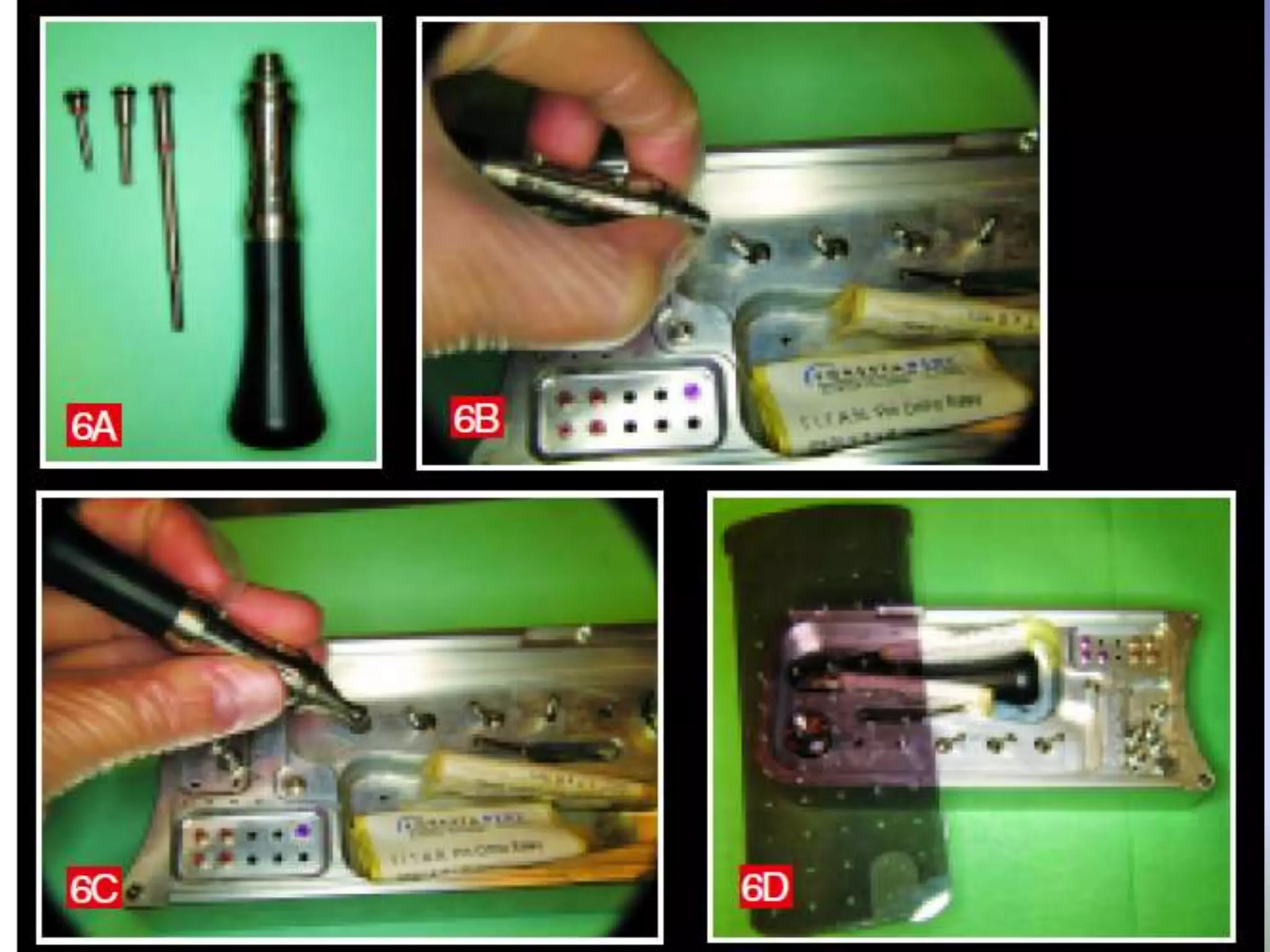 Temporary Anchorage Device (TAD) or Mini (screw ,implant) | PPTX