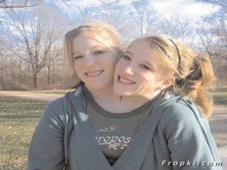 Real Human Deformities