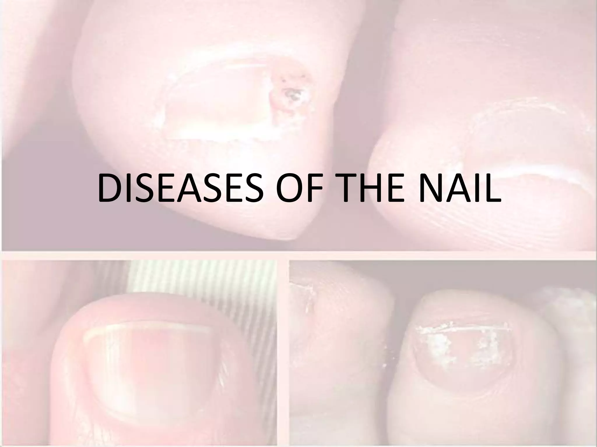 dermatology.nail disorder.(dr.mhamad usif) | PPTX