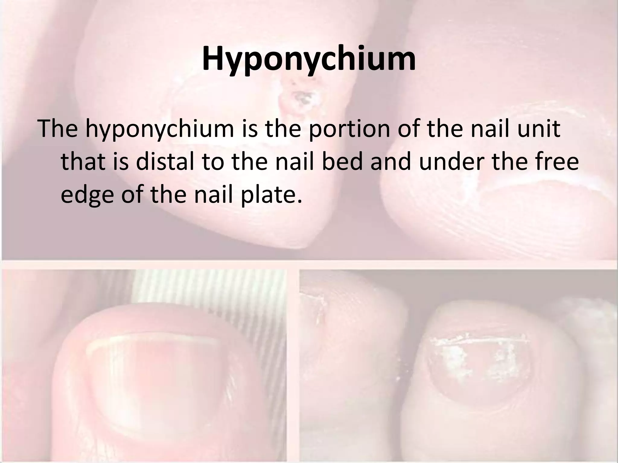 dermatology.nail disorder.(dr.mhamad usif) | PPTX