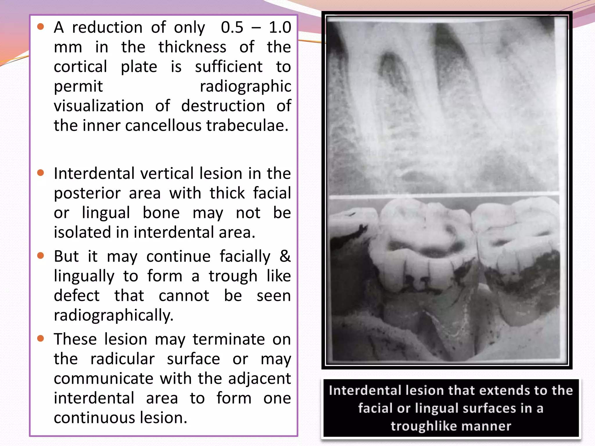 RADIOGRAPHIC AIDS IN THE DIAGNOSIS OF PERIODONTAL DISEASE | PPTX