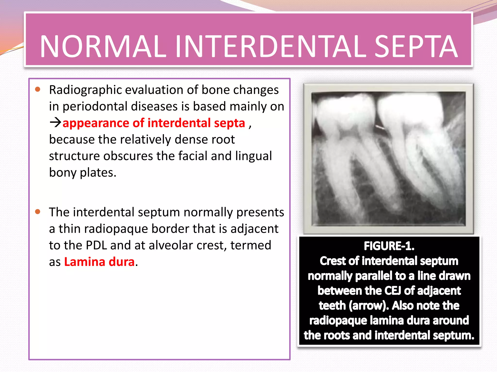 RADIOGRAPHIC AIDS IN THE DIAGNOSIS OF PERIODONTAL DISEASE | PPTX
