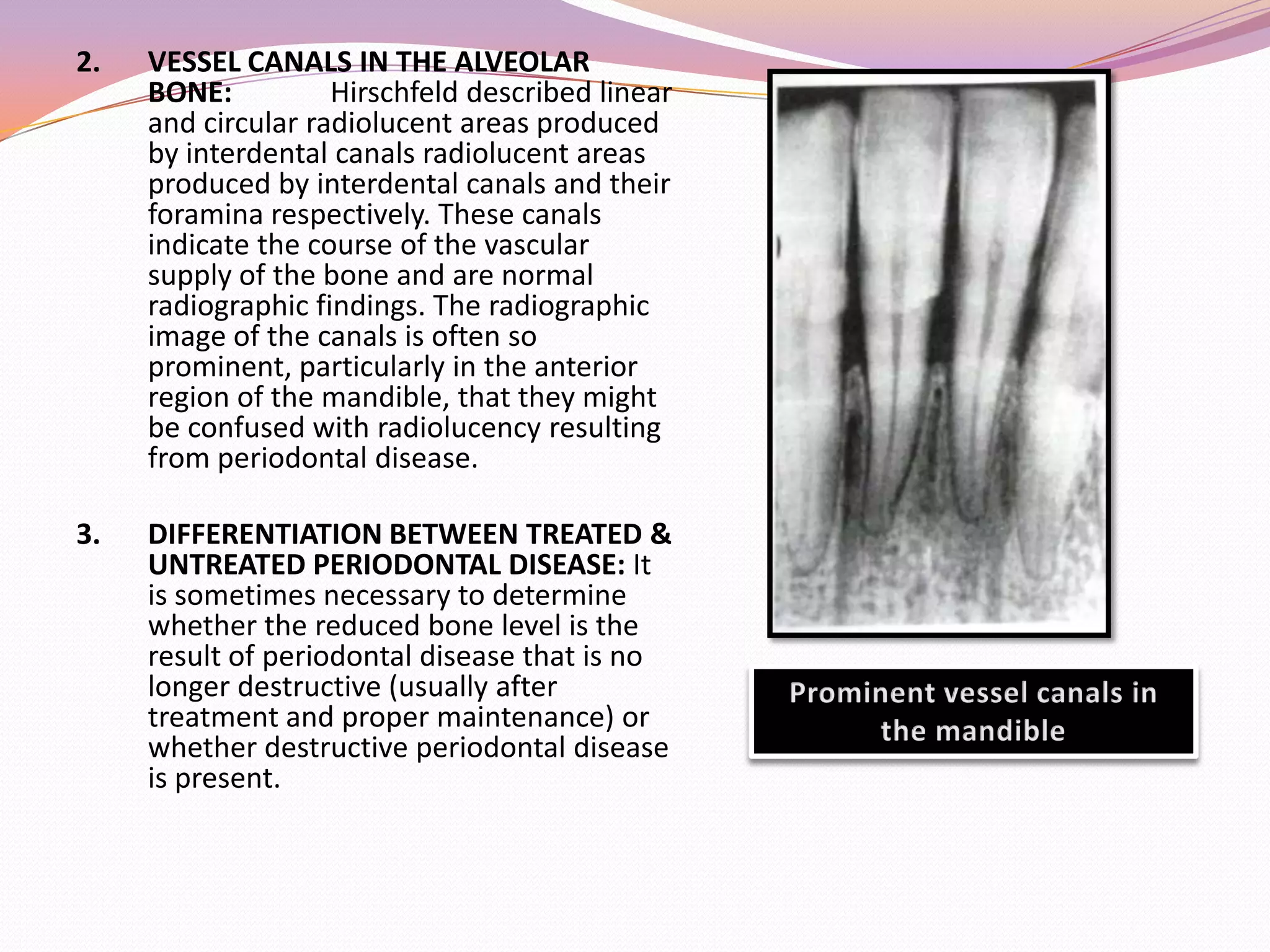 RADIOGRAPHIC AIDS IN THE DIAGNOSIS OF PERIODONTAL DISEASE | PPTX