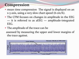 neonatal cerebral function monitoring | PPTX