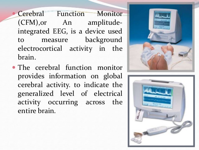 neonatal cerebral function monitoring