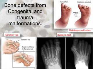 Engineering bone tissue using human Embryonic Stem Cells | PPT