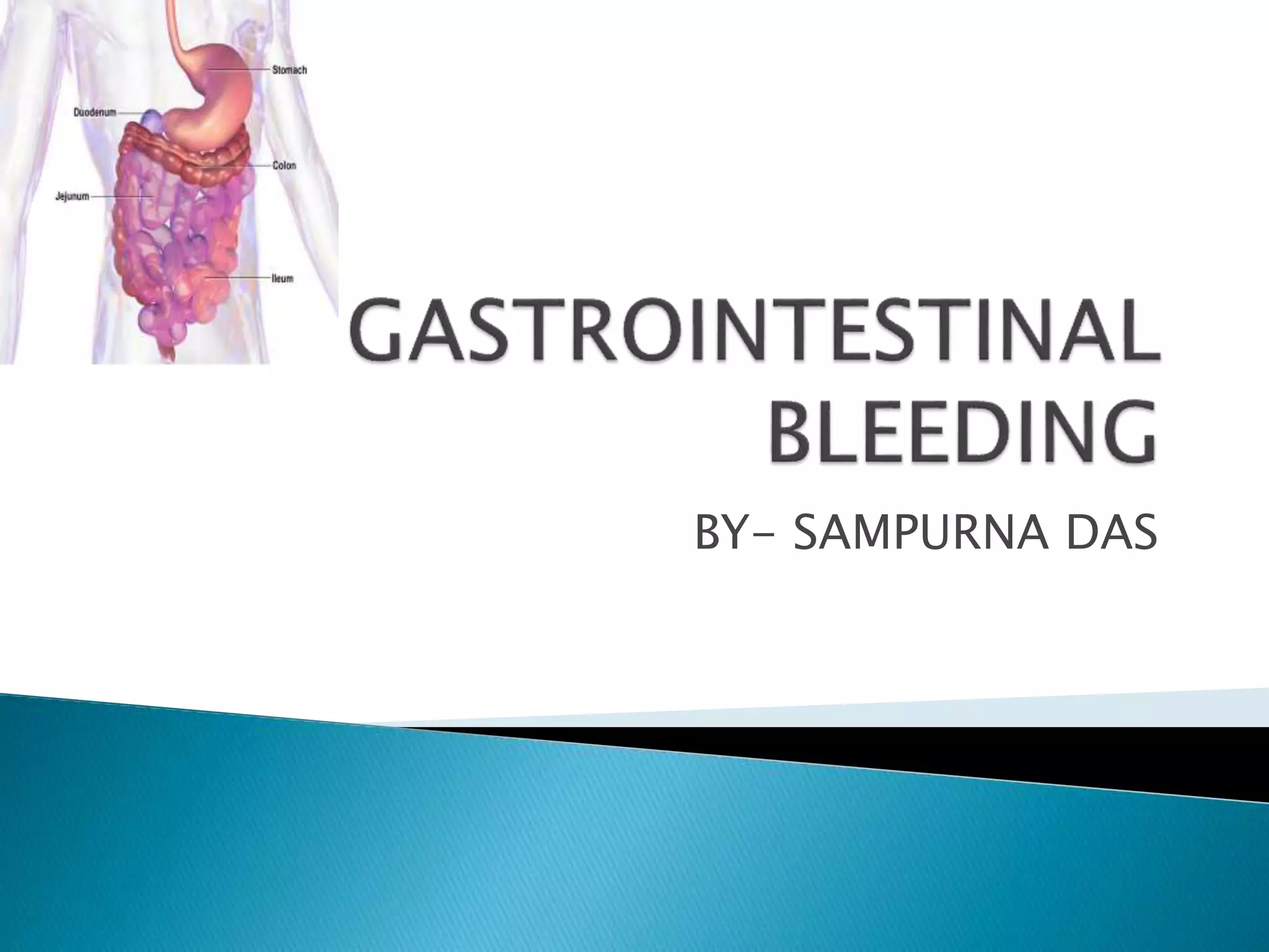 gastrointestinal bleeding | PPTX