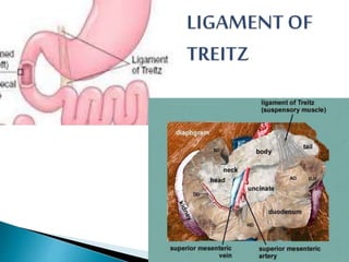 Ligament Of Treitz Cadaver
