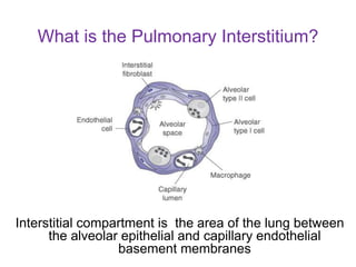 Approach To Interstitial Lung Diseases | PPTX