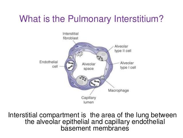 Approach Tov Interstitial Lung Diseases
