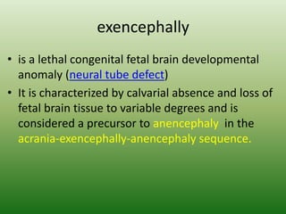 exencephaly..case