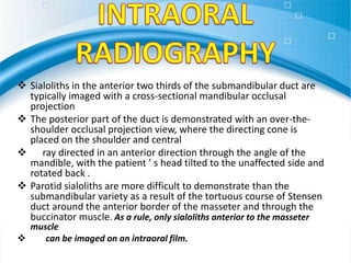 SALIVARY GLAND RADIOLOGY | PPTX