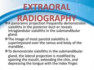 SALIVARY GLAND RADIOLOGY | PPTX