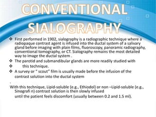 SALIVARY GLAND RADIOLOGY | PPTX