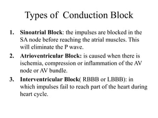 New microsoft office power point presentation | PPT