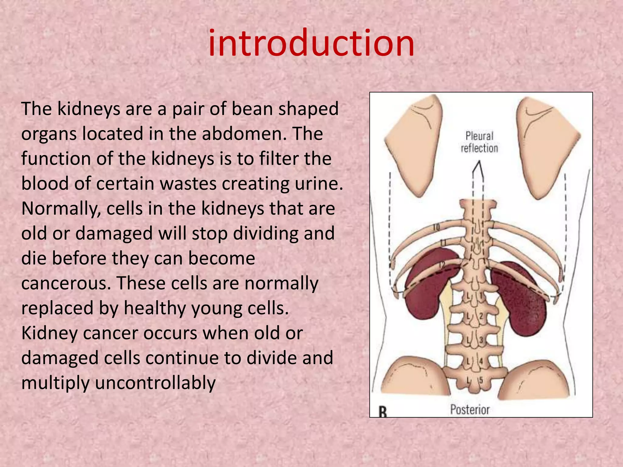 Kidney Cancer (renal cancer) | PPTX