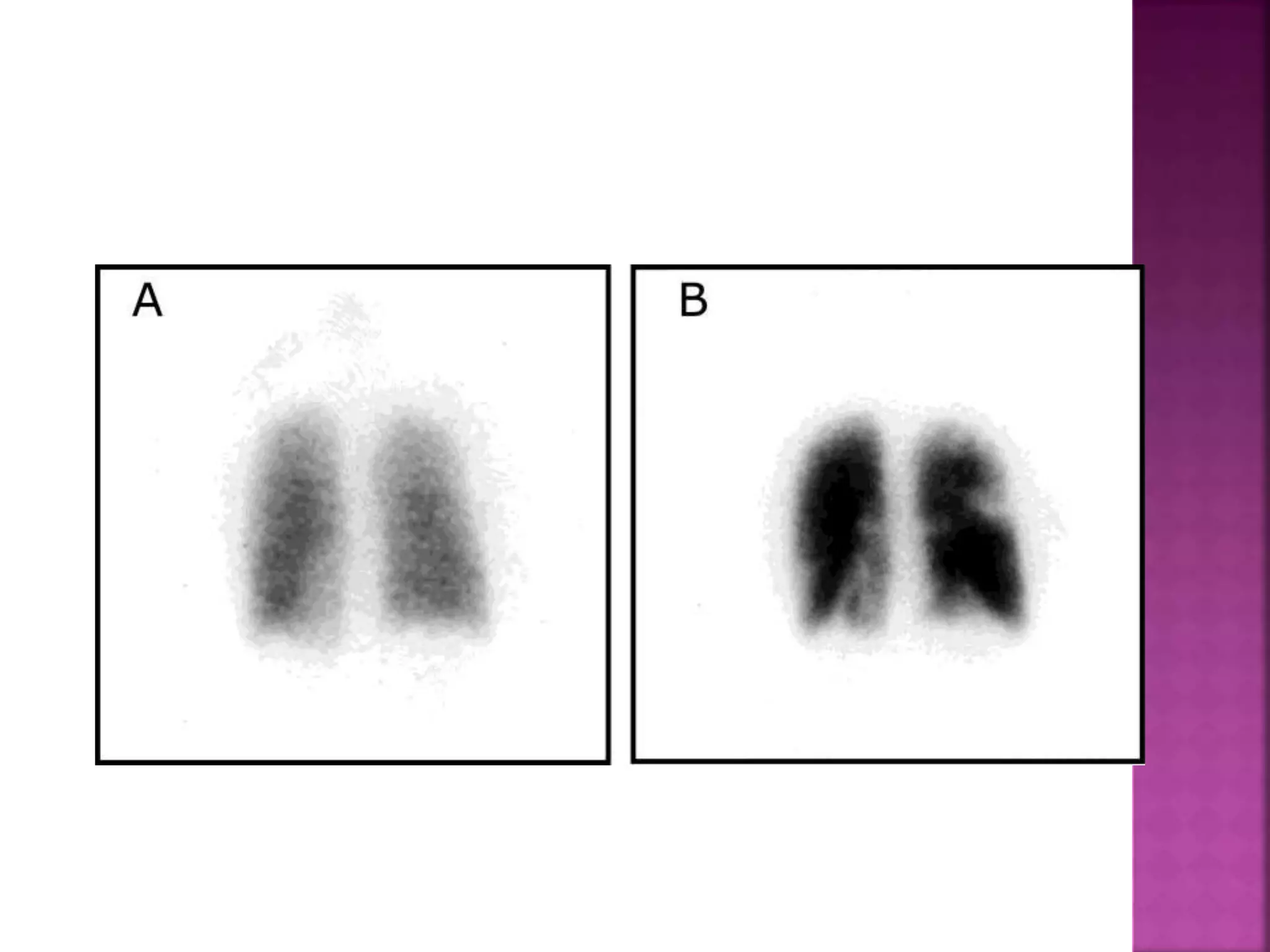 Radio isotopes in surgery | PPTX