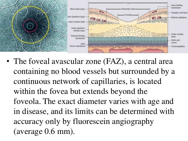 MACULAR DYSTROPHIES