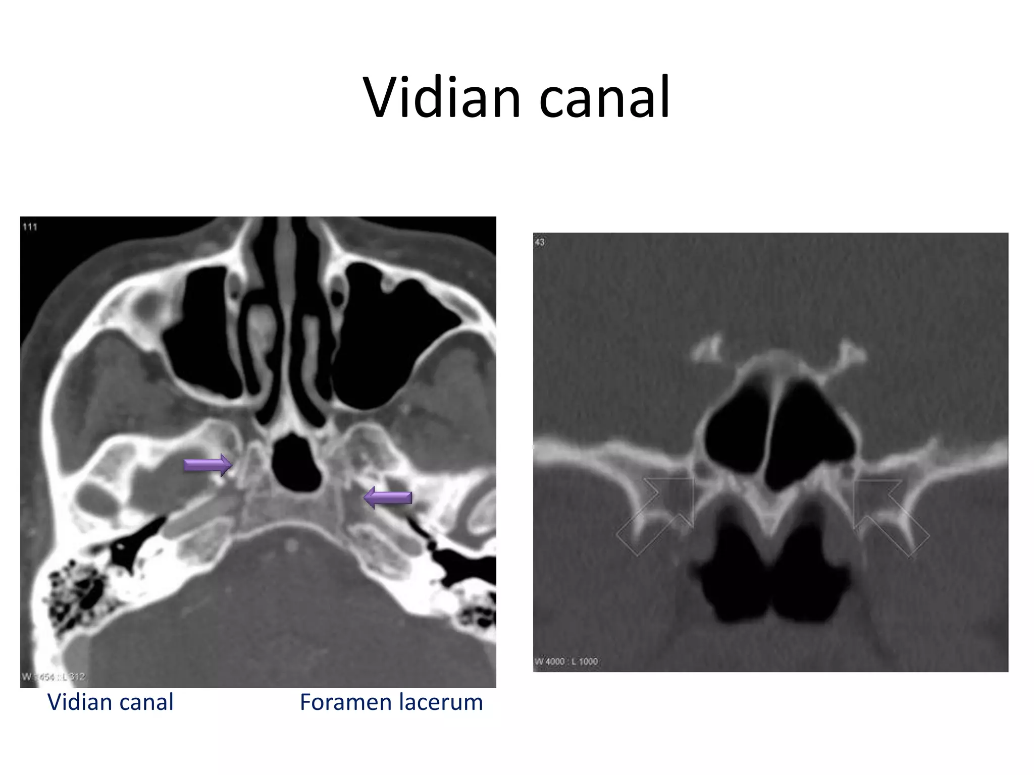 ARTERIAL AND VENOUS SUPPLY OF BRAIN | PPTX