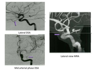 ARTERIAL AND VENOUS SUPPLY OF BRAIN | PPTX