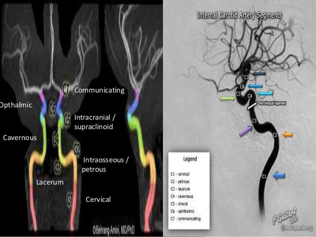 ARTERIAL AND VENOUS SUPPLY OF BRAIN