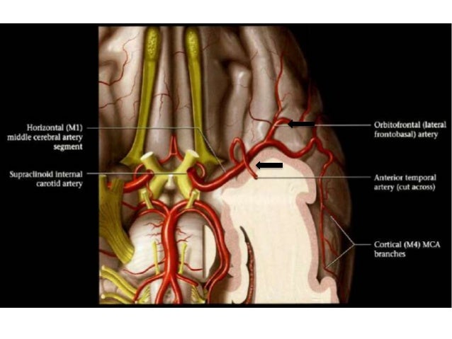 ARTERIAL AND VENOUS SUPPLY OF BRAIN