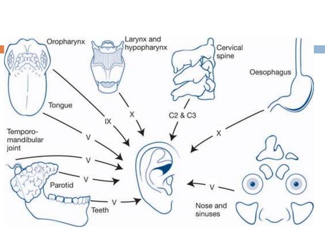 otalgia causes and management | PPTX | Ear, Nose and Throat Conditions ...