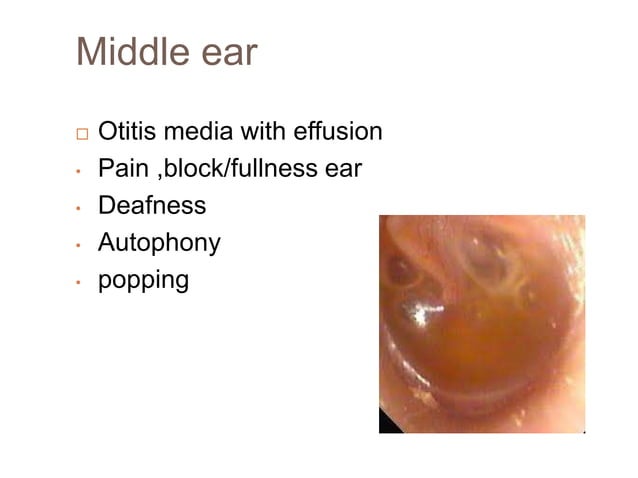 otalgia causes and management | PPTX | Ear, Nose and Throat Conditions ...