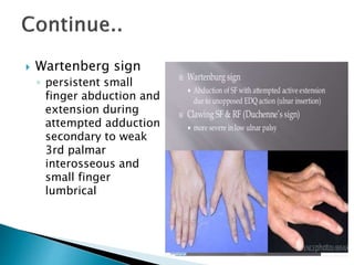 Cubital Tunnel Syndrome | PPTX