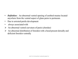 HYPOSPADIAS | PPTX